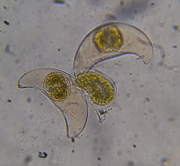Project: Pyrocystis Lunula | London Biohackspace